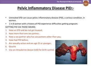 CBL INFERTILITY.pptx | Free Download