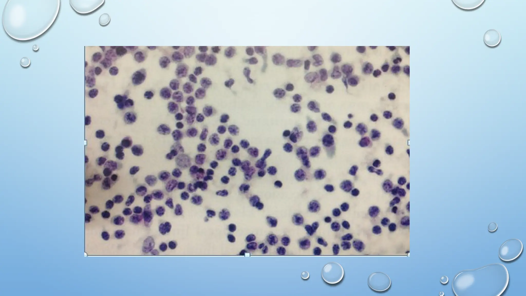 CBME-CSF CHARTS 2nd yearb pathology.pptx