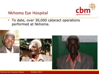 Nkhoma Eye Hospital | PPT