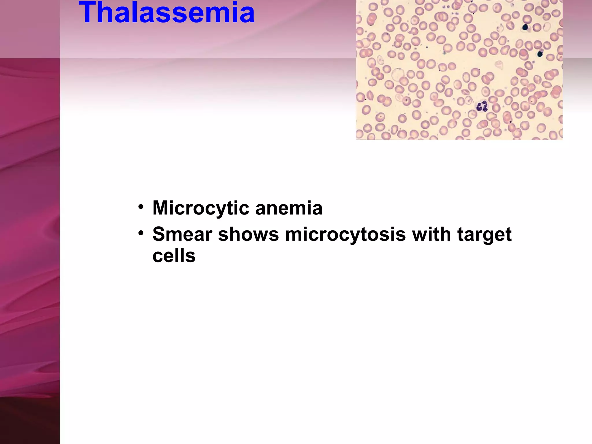 Cbp (3)complete blood picture | PPT