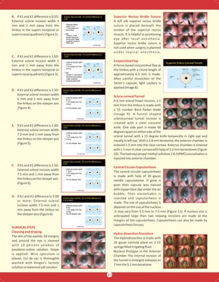 Optho Times Vol 6 (1-28) | PDF