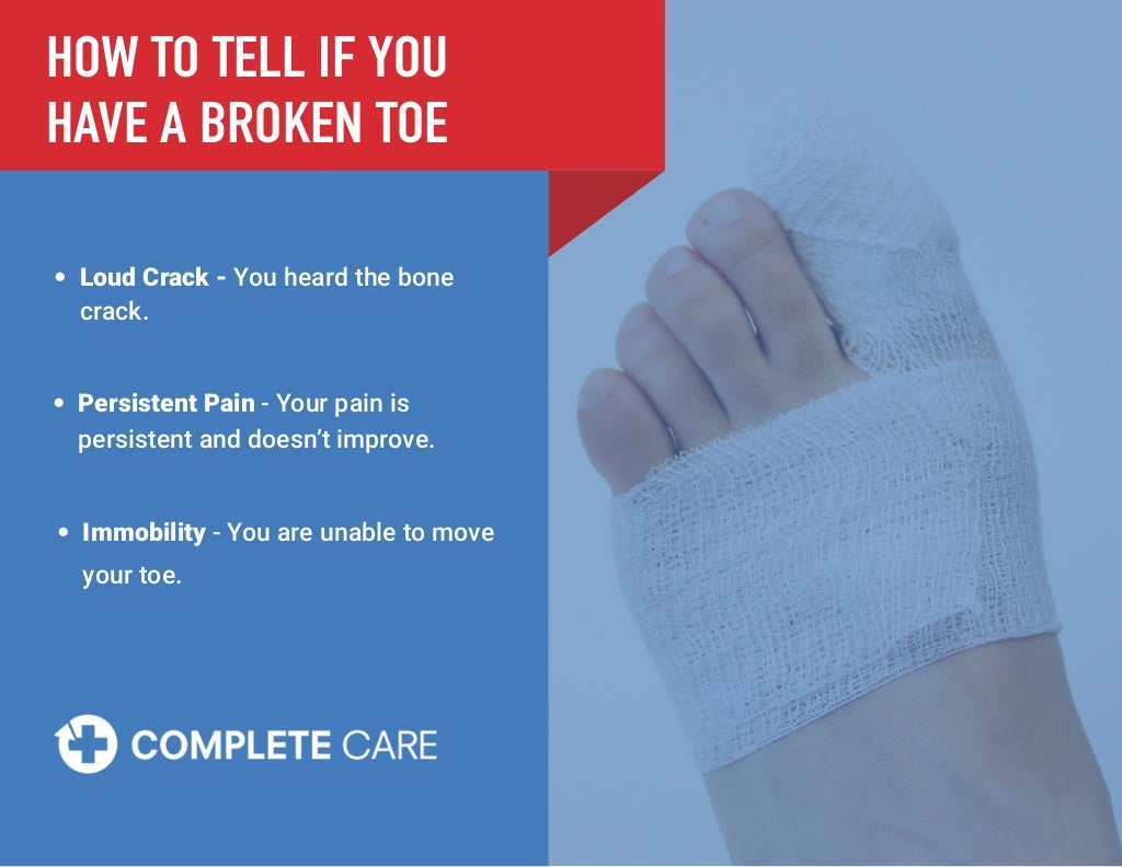 Sprained Toe Vs Broken Toe How To Tell The Difference sprained-toe-vs-broken-toe-how-to-tell-the-difference