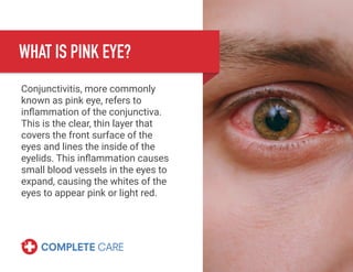 Pink Eye Symptoms & Treatment | PDF