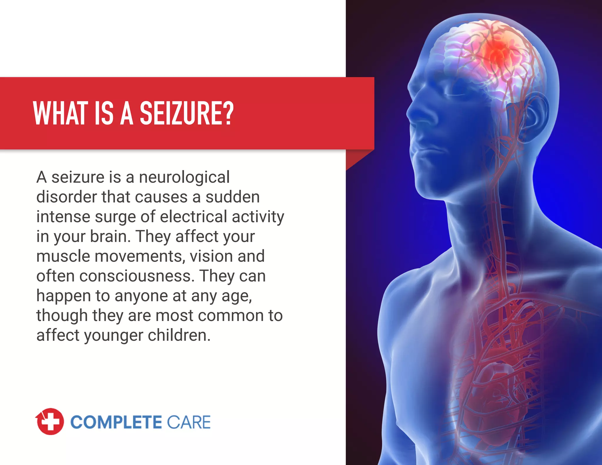 Seizures: Symptoms, Treatment & More | PDF