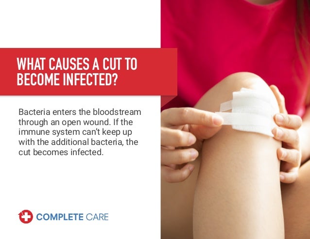 How to Tell If a Cut is Infected