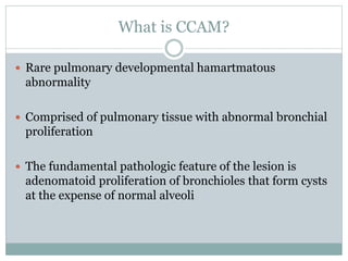 Congenital cystic adenomatoid malformation | PPTX