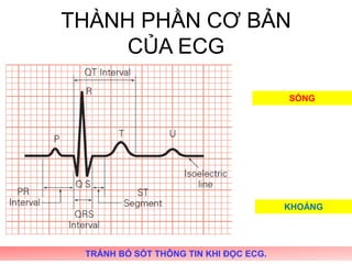 CÁC BƯỚC ĐỌC ECG | PDF