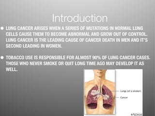 Lung Cancer | PPT