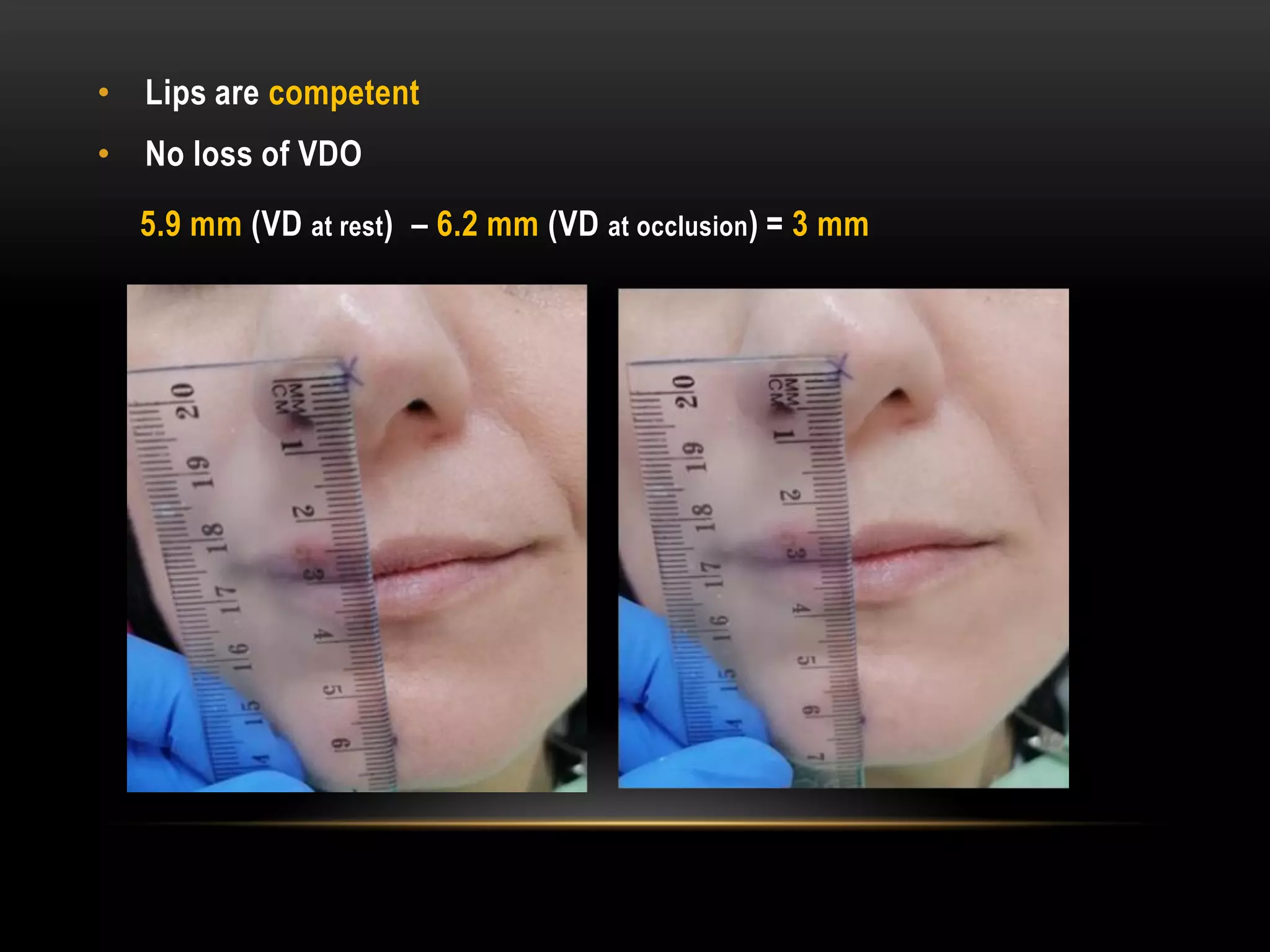 Dental Clinical Comprehensive Case (CCC) | PDF