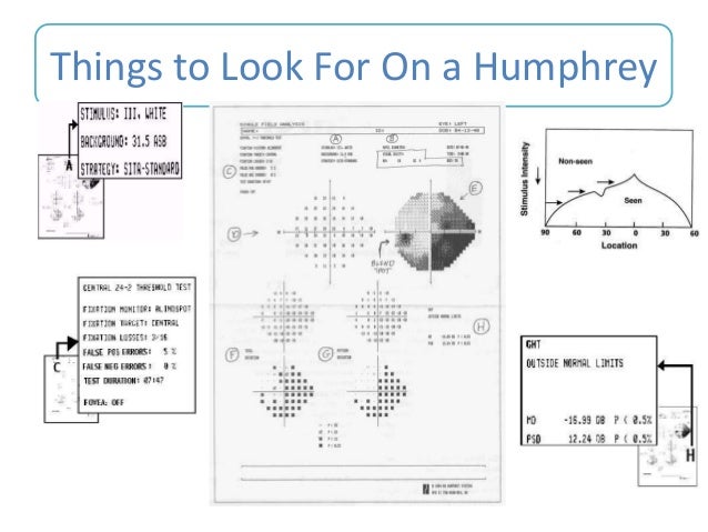 Interpreting Visual Fields Interpreting Visual Fields