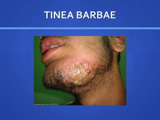 CCDM, Control of Communicable Diseases in Man | PPTX