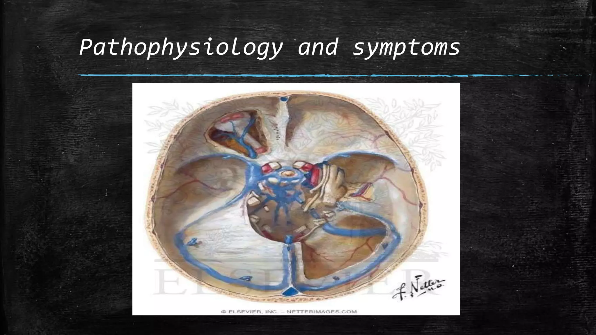 Carotid cavernous fistula | PPTX