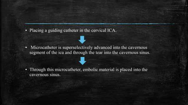 Carotid cavernous fistula | PPTX