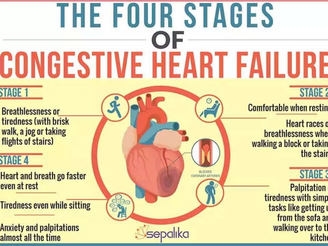 CCF cardiac nursing including pathophysiology and nursing diagnosis ...