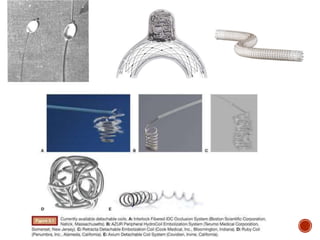 TRAUMATIC CCF | PPTX