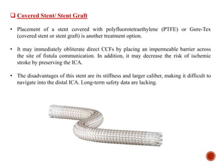 TRAUMATIC CCF | PPTX