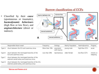 TRAUMATIC CCF | PPTX