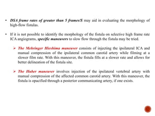 TRAUMATIC CCF | PPTX