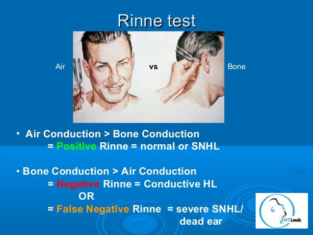 How to recognise ENT Cancers (or how to spot the icebergs)?