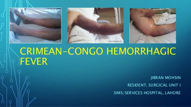 Crimean-Congo Hemorrhagic Fever (CCHF)