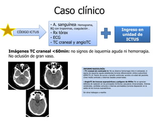 Código ICTUS ictus vertebrobasilar | PDF