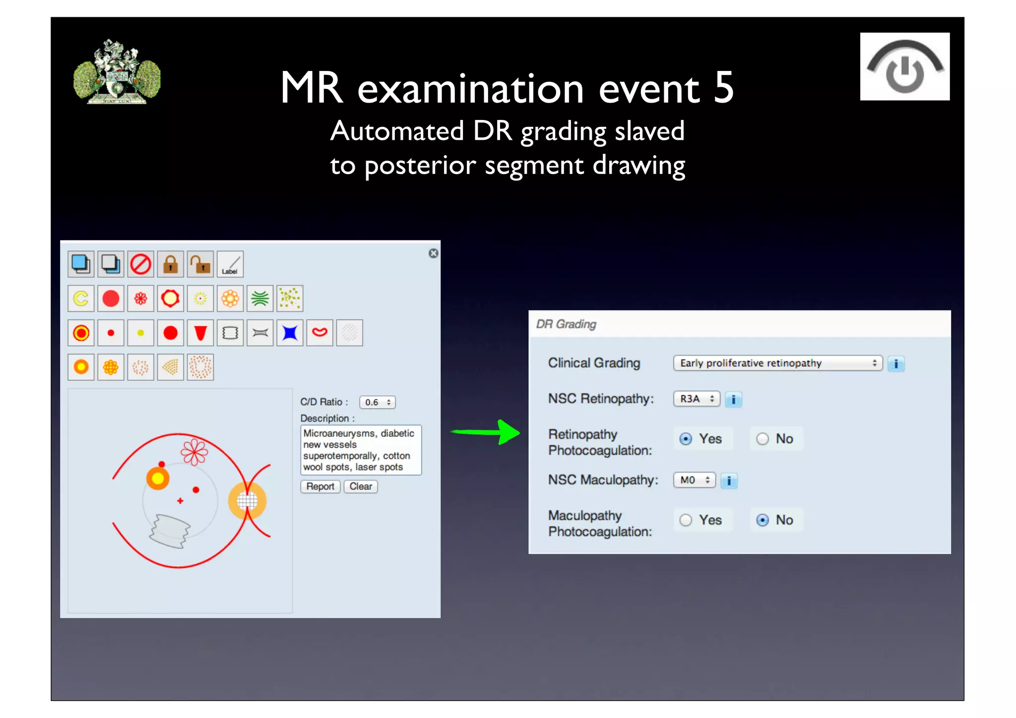 Medical retina functionality, OpenEyes demonstration, Dr Tim Elliott, OpenEyes project manager | PDF