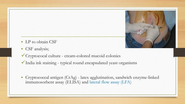 Case Presentation Cryptococcal Meningitis | PPT