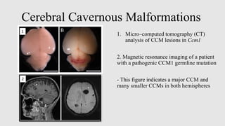 CCM Organoids ppt.pptx