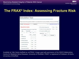 osteoporosis - prostate cancer | PPT