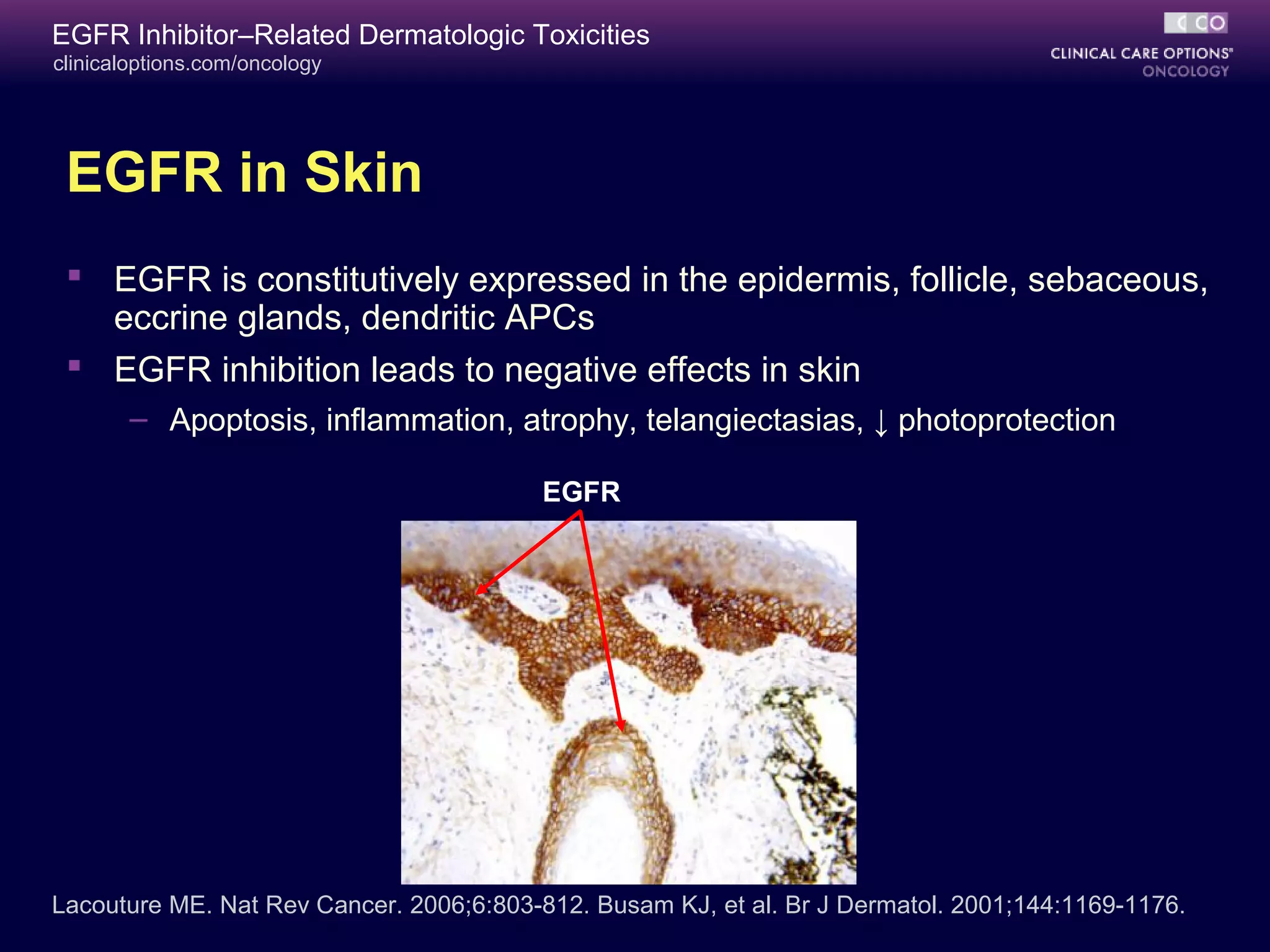 Cco egfr toxicities_2012_slides | PPT