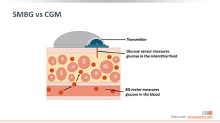 CCO_ENDO_CGM2022_Downloadable.pptx