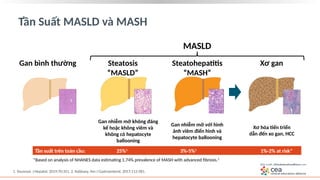 CCO_MASLD_MASH Screening and Diagnosis.pptx