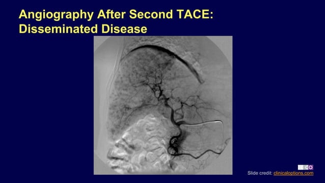 CCO_VEGF_GI_Cancers_Downloadable.pptx