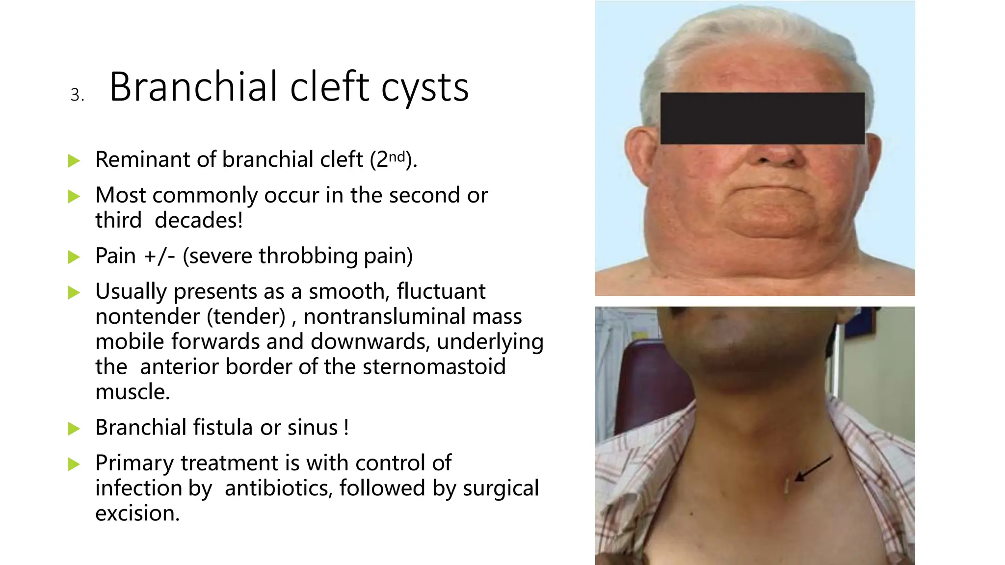 CCP9- Central Neck Mass.pptxkkkkkkkkkkkkkk | PPTX