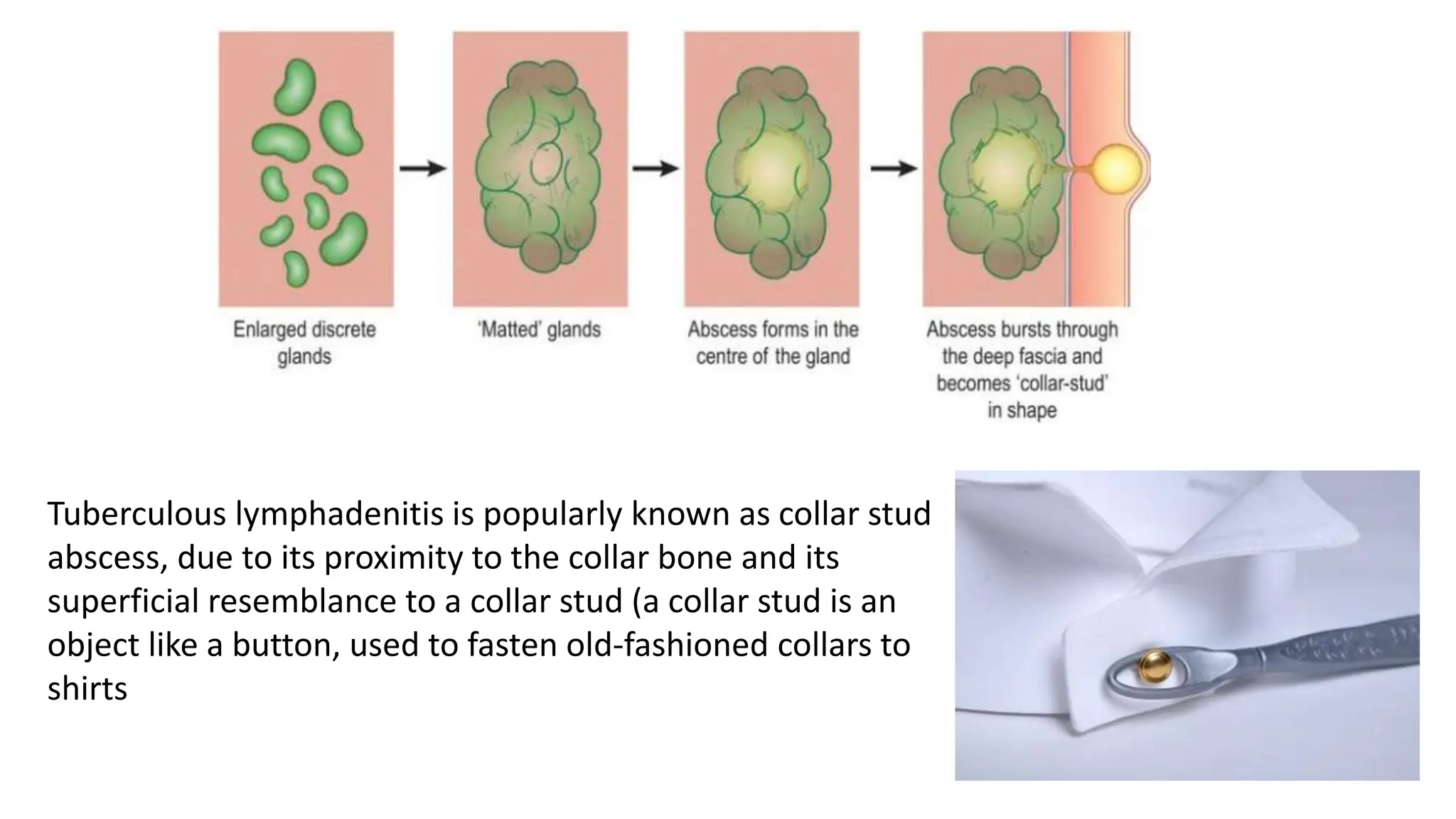 CCP9- Central Neck Mass.pptxkkkkkkkkkkkkkk | PPTX