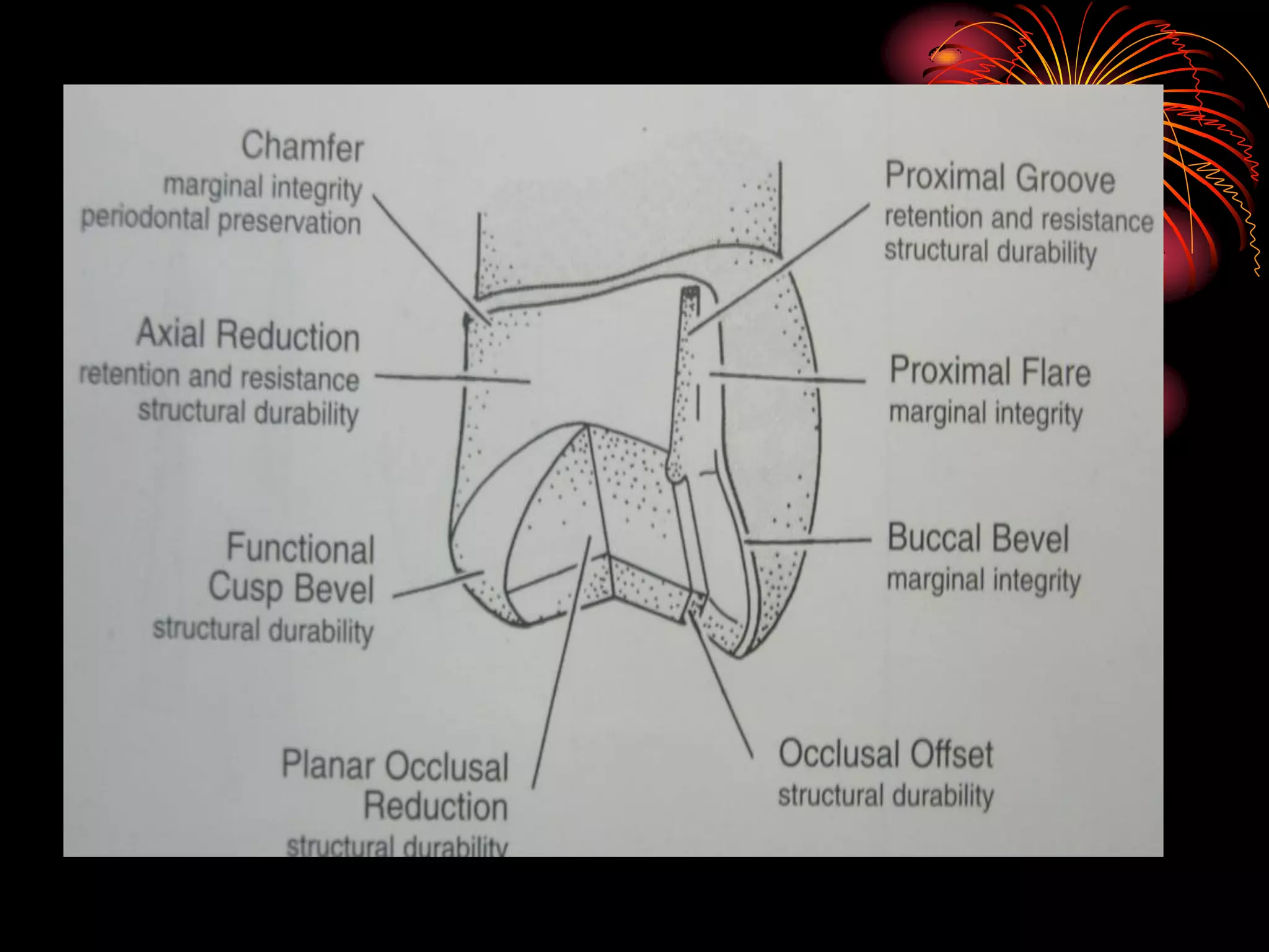 partial coverage restorations | PDF | Dental Health | Diseases and ...
