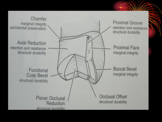 partial coverage restorations | PDF