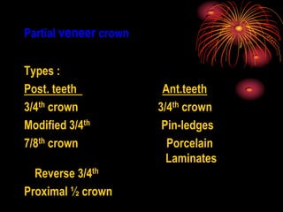 partial coverage restorations | PDF