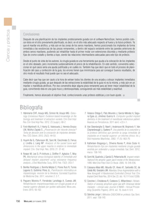 Implantes múltiples inmediatos en el maxilar superior mediante cirugía ...