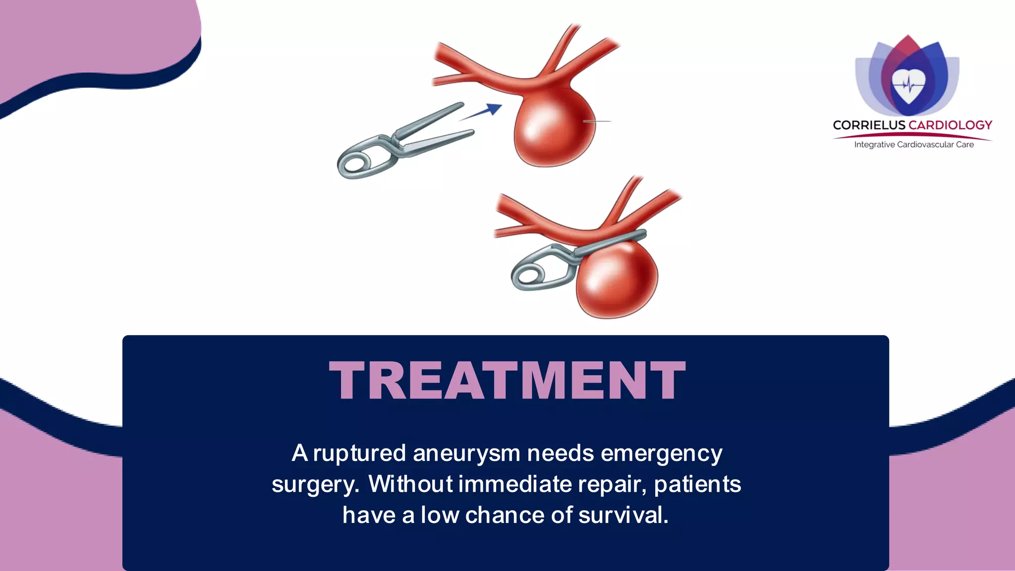 Aneurysm: Types, causes & treatment | PPTX