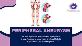 Aneurysm: Types, causes & treatment | PPTX