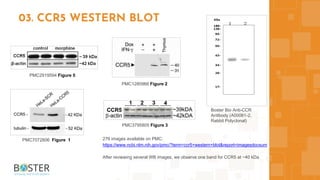 Learn CCR5 in 3 minutes | C-C chemokine receptor type 5, CD195 | PPTX