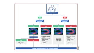 mater dr. Personaldi, ESC guideline CCS.pptx