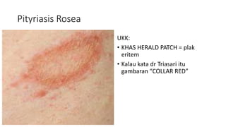 CC vita mbak zozo agung.pptx