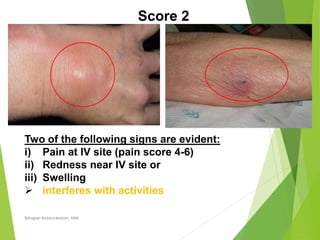 nursing indicator thrombophlebitis.pptx