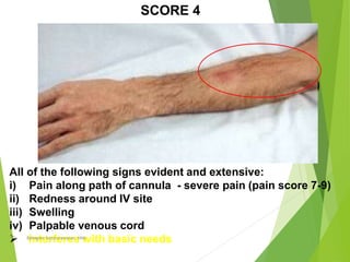 nursing indicator thrombophlebitis.pptx
