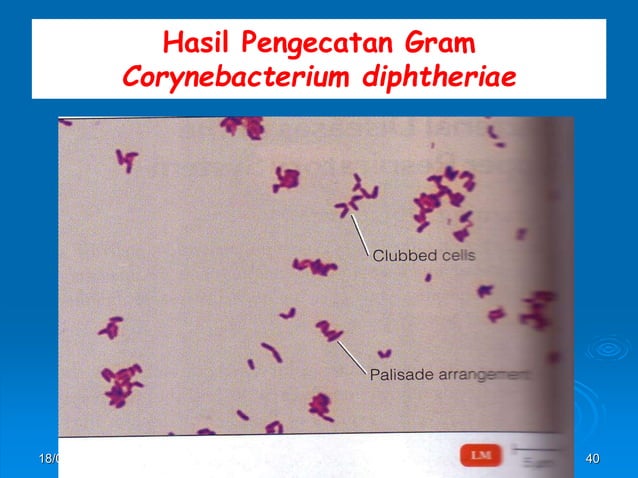 corynebacterium diptheri bakteriumm .ppt