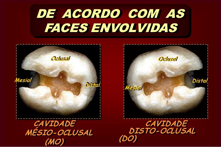 Nomenclatura e classificação de cavidades