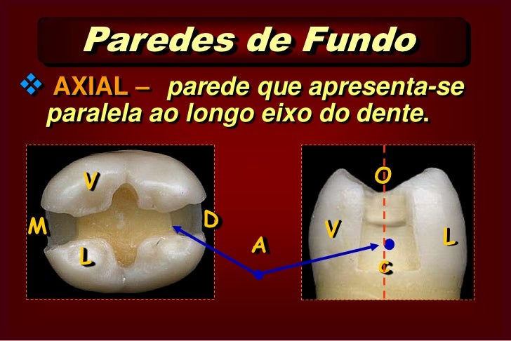 Nomenclatura e classificação de cavidades
