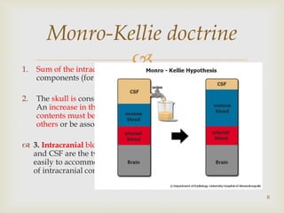 Monro Kellie Doctrine